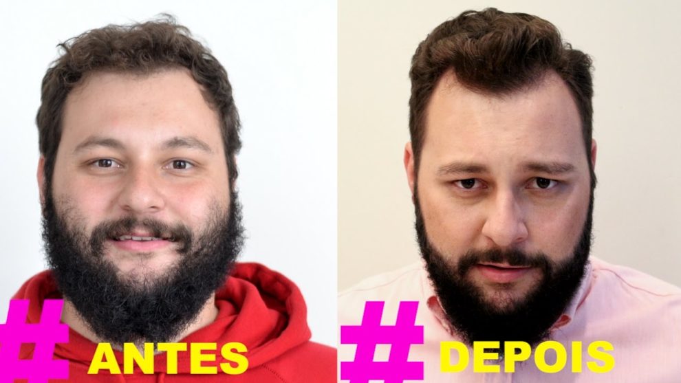 Top 8 Melhores Tipos de Barba para Rosto Redondo - Como Ter Barba